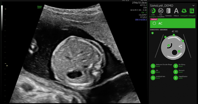 GE Voluson SWIFT – Shun On Healthcare