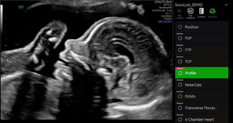 GE Voluson SWIFT – Shun On Healthcare